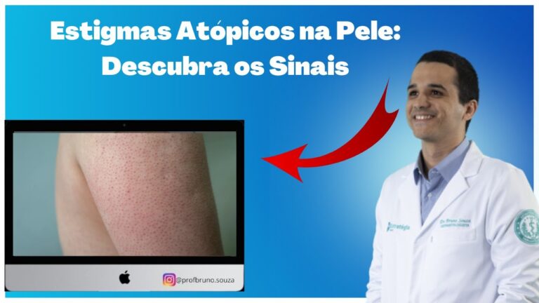 Sinal de Dennie Morgan: O que é e como tratar | Actualizado enero 2026