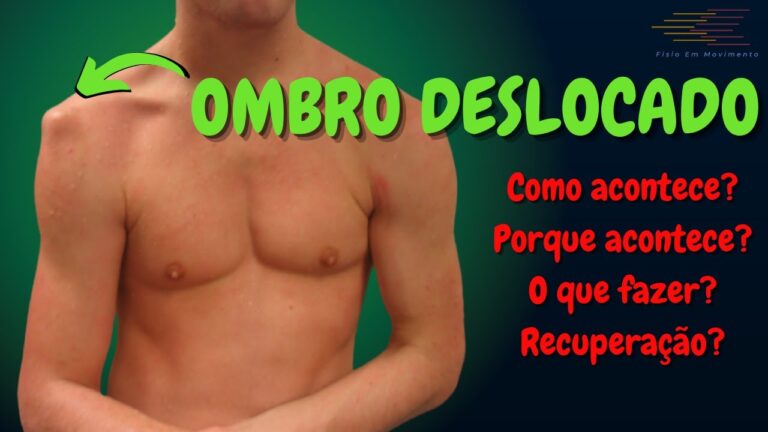 Ombro Deslocado: Causas, Sintomas e Tratamento | Actualizado mayo 2026