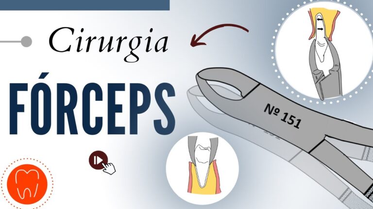 Guia completo sobre o uso de forceps odontológico | Actualizado octubre ...