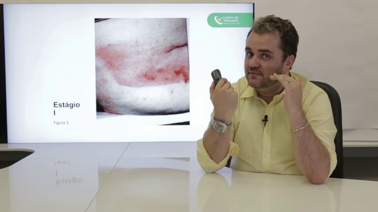 Fotos da Úlcera de Marjolin: Uma Visão Concisa | Actualizado septiembre ...