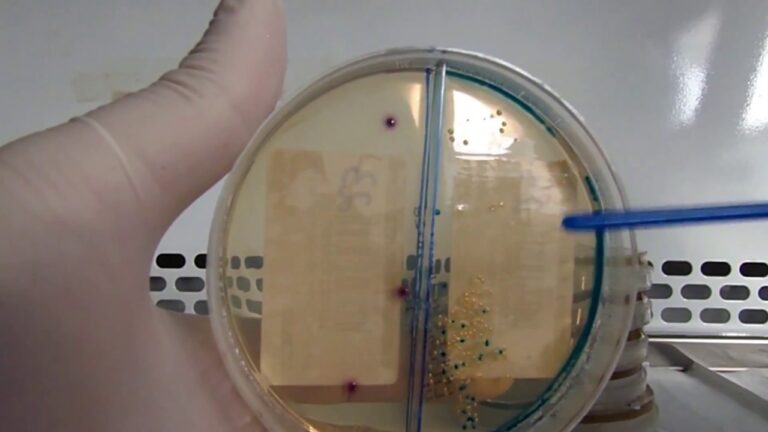 Análise de Cultura de Urina com Contagem de Colônias: Importância e ...