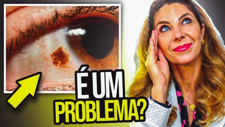 Mancha Marrom no Olho: Possíveis Causas e Tratamentos | Actualizado septiembre 2025