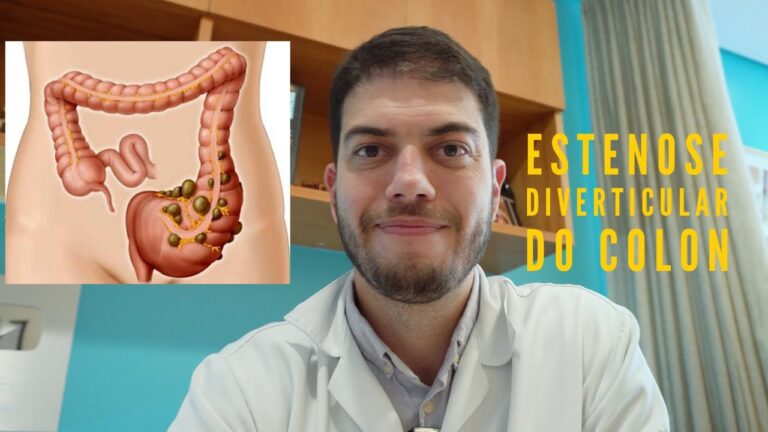 Estreitamento Intestinal: Causas, Sintomas e Tratamento | Actualizado ...