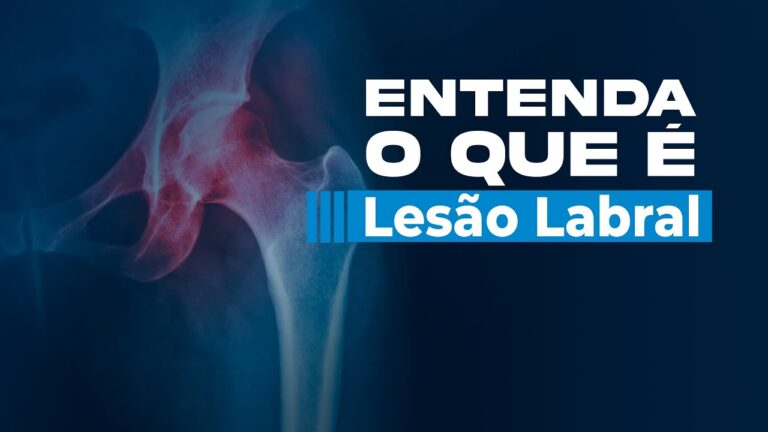 Lesão de Labrum: Causas, Sintomas e Tratamentos | Actualizado diciembre ...