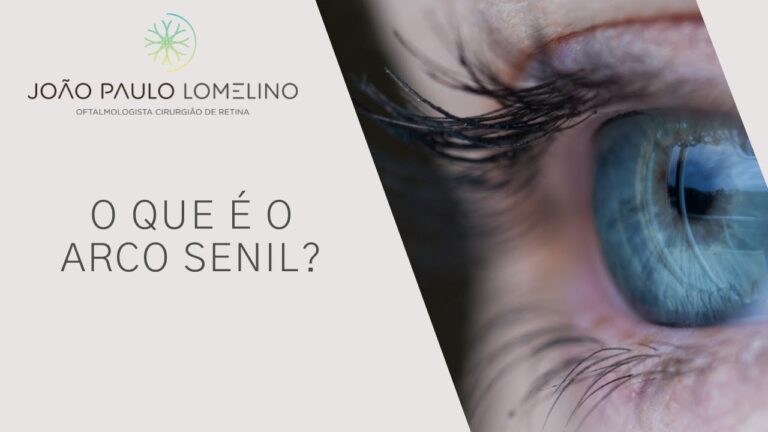 Arco Senil nos Olhos: Causas e Tratamentos | Actualizado diciembre 2025