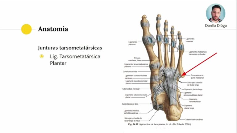 Fraturas do Quinto Metatarso: Diagnóstico e Tratamento | Actualizado ...