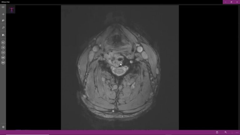 Exame de imagem para detectar câncer na coluna: uma análise completa ...