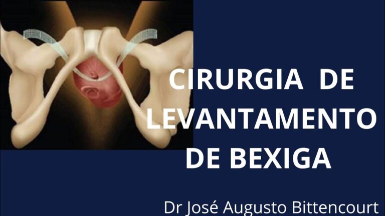 Entenda a Bexiga Caída: Termo Técnico e Tratamentos | Actualizado enero ...