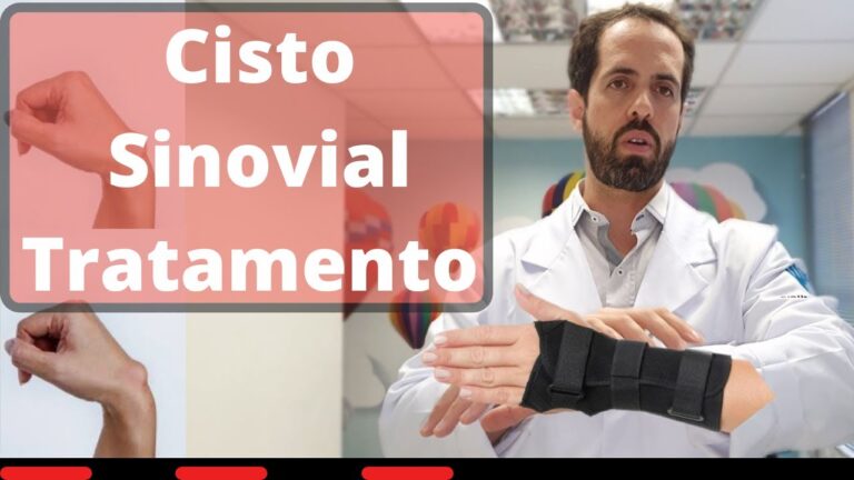 Sintomas do Cisto Sinovial: O que você precisa saber | Actualizado ...