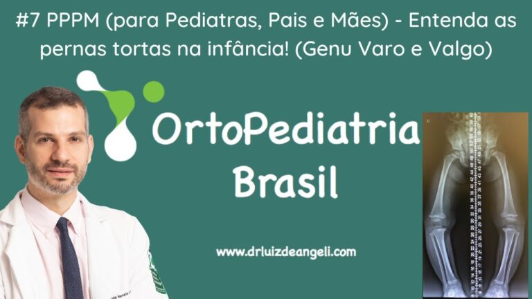Correção de Pernas Tortas para Dentro | Actualizado diciembre 2025