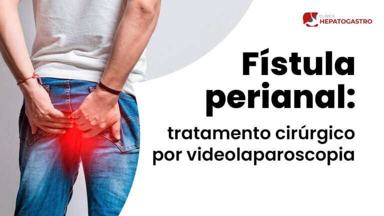 Cirurgia de Fístula Perianal: Procedimento e Recuperação | Actualizado ...