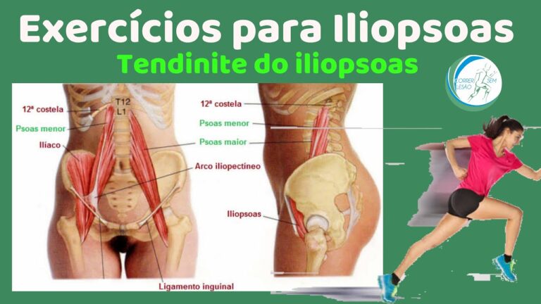 Guia Completo dos Sintomas de um Iliopsoas Inflamado | Actualizado diciembre 2025
