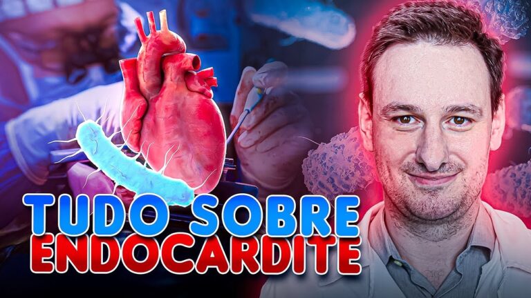 Principais Critérios de Duke para Endocardite | Actualizado mayo 2026