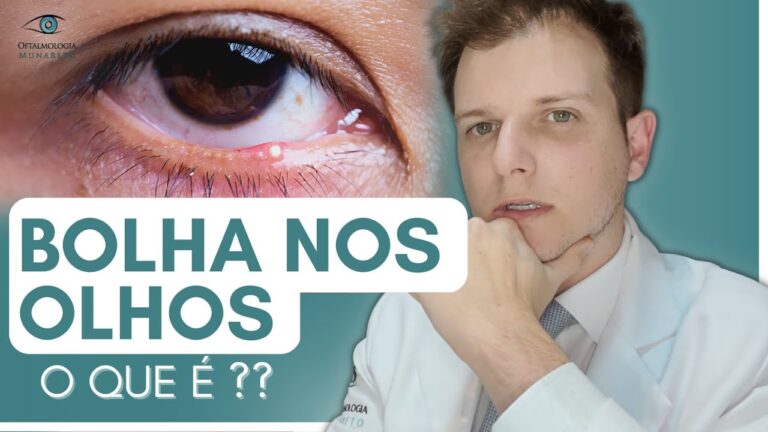 Caruncula Lacrimal Vermelha: Função e Cuidados Essenciais | Actualizado ...