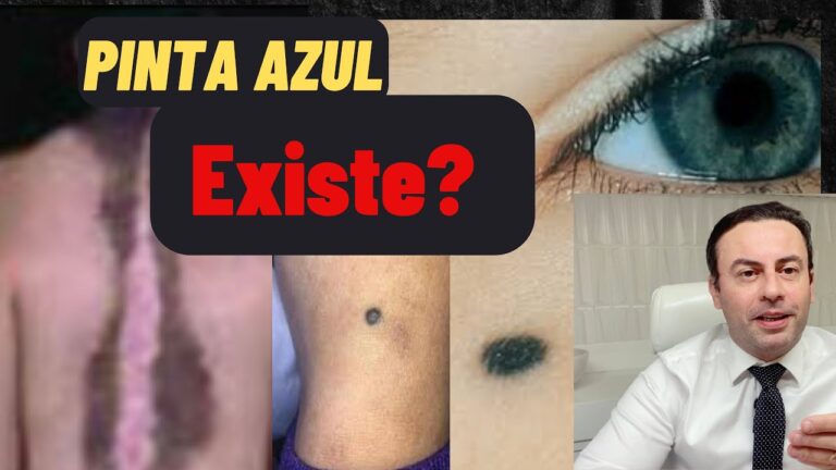 A Incrível Pinta Azul: Conheça Esta Espécie Fascinante | Actualizado ...