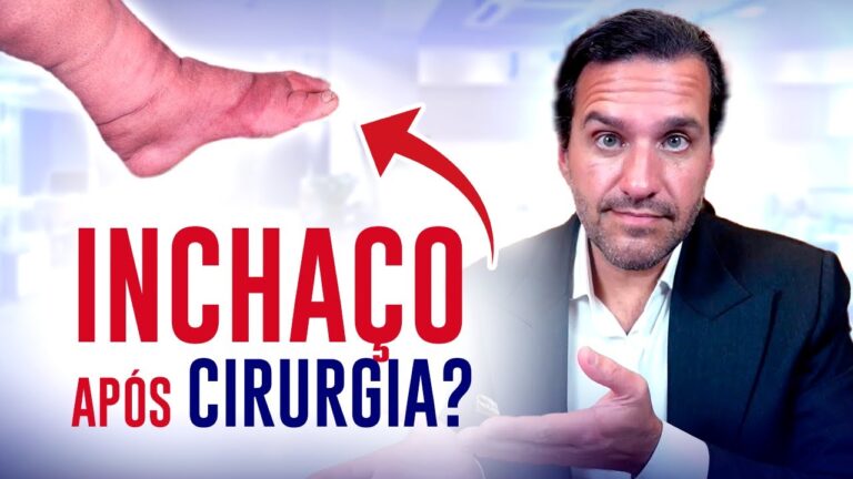 Como Lidar com Perna Inchada após Cirurgia de Joelho | Actualizado ...
