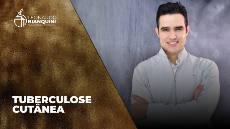 Tuberculose Cutânea: Diagnóstico e Tratamento em Fotos | Actualizado ...