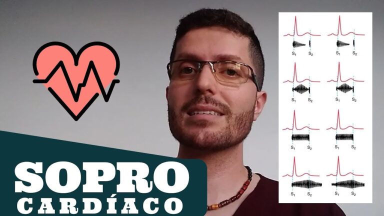 Tipos de Sopros Cardíacos: Guia Completo | Actualizado diciembre 2025