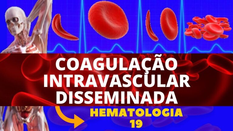 CIVD: Entendendo o que é e suas implicações | Actualizado noviembre 2025