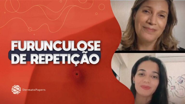 Tratamento eficaz da furunculose: opções e cuidados. | Actualizado mayo ...