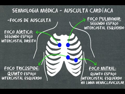 Localização do Foco Pulmonar na Ausculta Cardíaca | Actualizado octubre ...