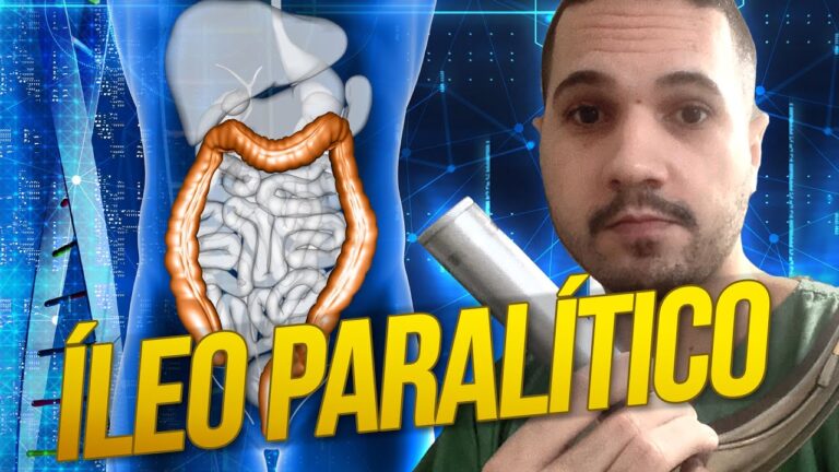 Principais Causas do Íleo Paralítico | Actualizado septiembre 2025