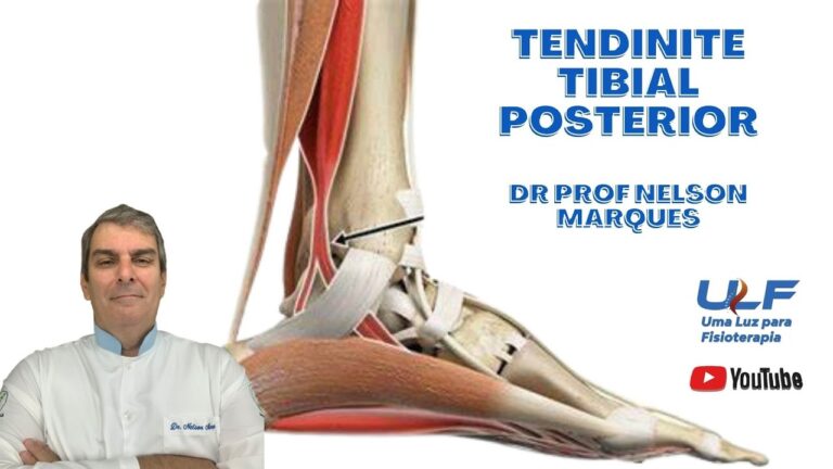 Tenossinovite do tendão tibial posterior: Causas, Sintomas e Tratamento ...