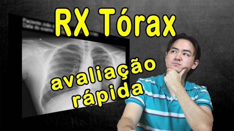 Raio X do Pulmão Normal: Interpretação e Importância | Actualizado ...