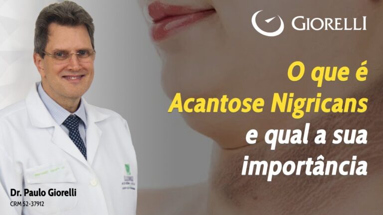 Entendendo a Acantose Nigricans: Causas e Tratamentos | Actualizado ...