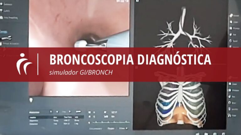 Entendendo o Processo da Broncoscopia | Actualizado diciembre 2025
