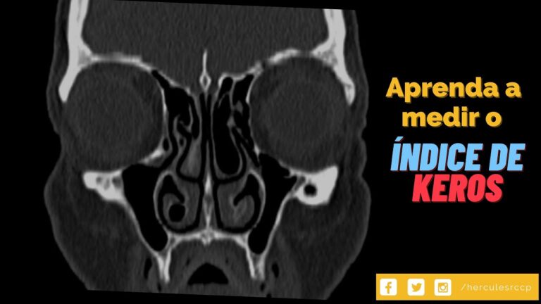 Tratamento Eficiente de Keros Tipo 2 | Actualizado diciembre 2025