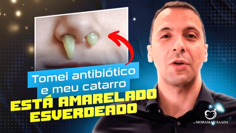 Amoxicilina no Tratamento do Catarro Pulmonar | Actualizado octubre 2025