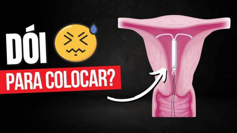 Dói Colocar o Diu? Entenda o Processo e Alívio | Actualizado diciembre 2025