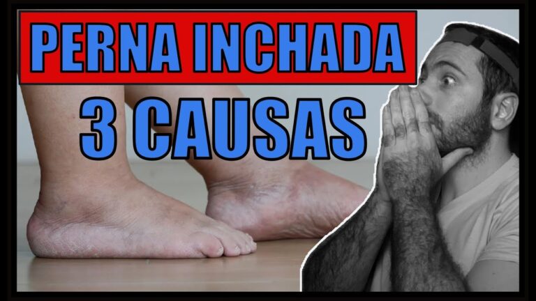 Causas e Tratamentos para Canelas Inchadas | Actualizado diciembre 2025