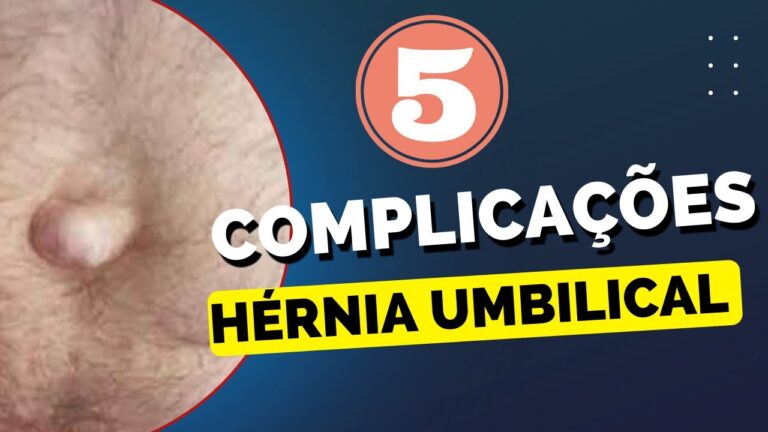 Cuidados com o Umbigo Após Cirurgia de Hérnia Umbilical | Actualizado octubre 2025