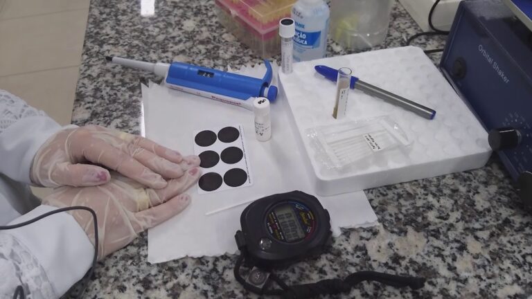 Significado da Antiestreptolisina 400: O Que Você Precisa Saber ...