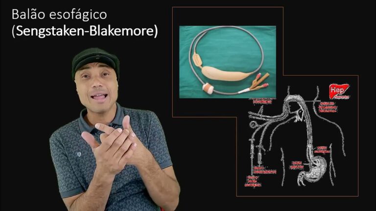 Balao de Sengstaken-Blakemore: Indicações e Técnicas de Uso ...