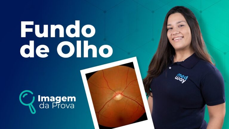 Interpretando a Fundoscopia Normal: O Que Esperar e Como Entender os ...