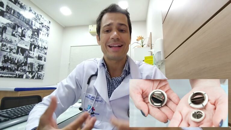 Avanços na Cirurgia de Prótese Valvar Mitral | Actualizado diciembre 2025