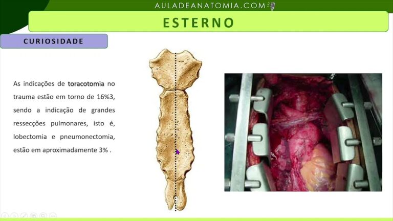 Entendendo o Processo Xifóide do Esterno: Função e Importância ...