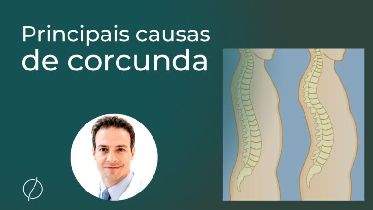 Tipos de Corcunda: Entenda as Variedades e Causas | Actualizado marzo 2026