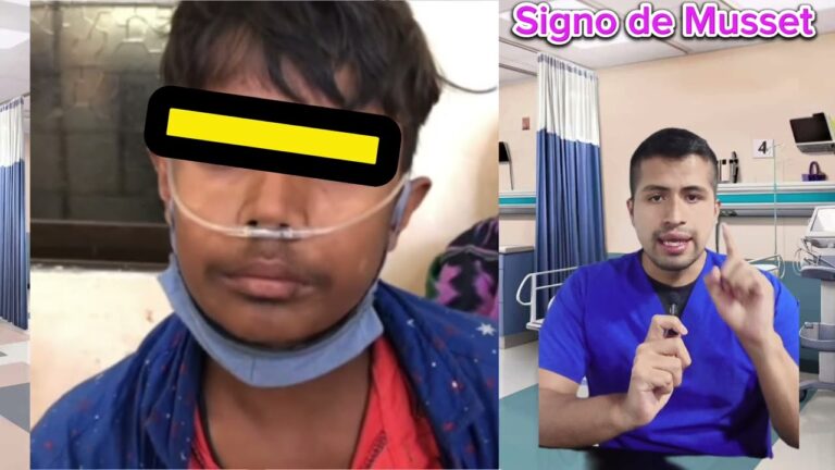 Entendendo o Sinal de Musset: Causas e Implicações Clínicas ...
