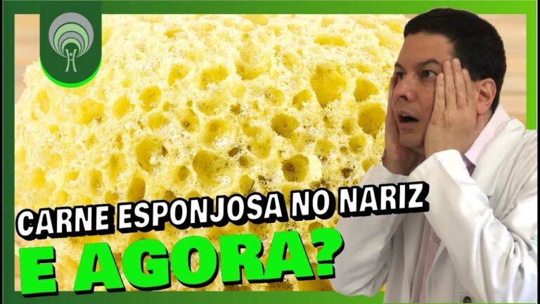 Como Tratar Carne Esponjosa no Nariz | Actualizado diciembre 2025
