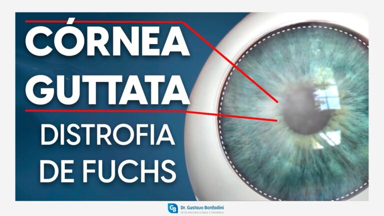 Gutata Ocular: Causas, Sintomas e Tratamentos Eficazes | Actualizado ...