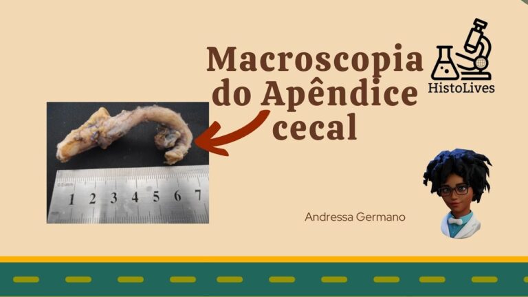 Anatomia do Apêndice Cecal: Estruturas e Funções Essenciais ...