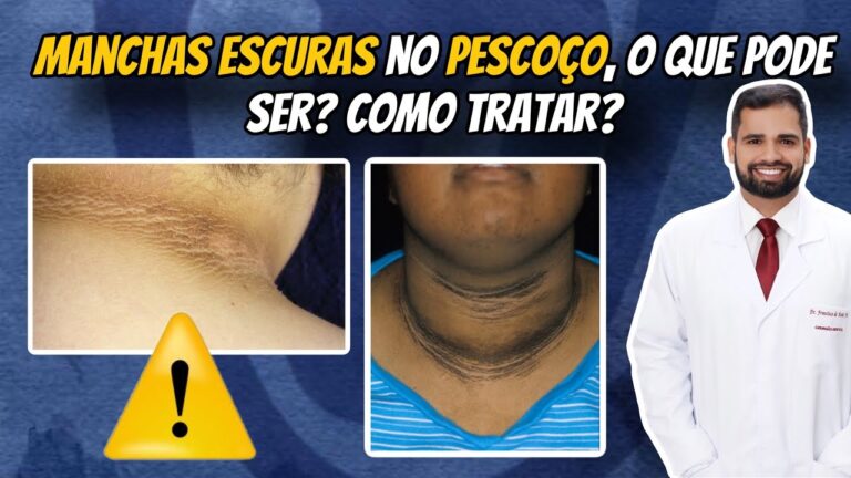 USA: Estilos e Tendências de Uso ao Redor do Pescoço | Actualizado ...