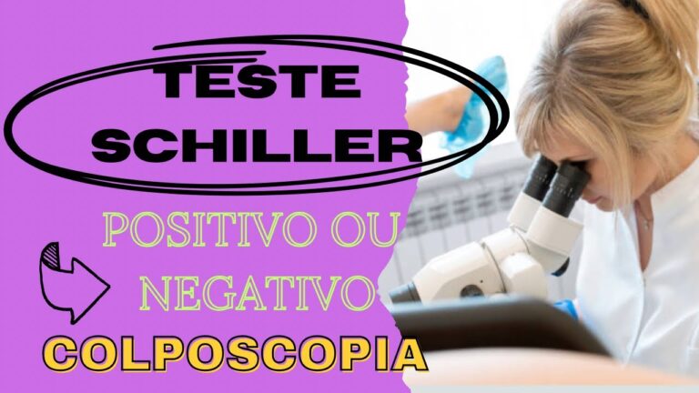 Entendendo o Schiller Positivo: Conceitos e Importância | Actualizado ...